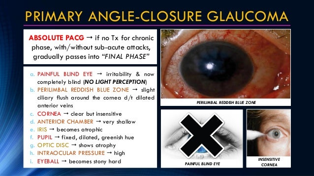 Primary Glaucoma