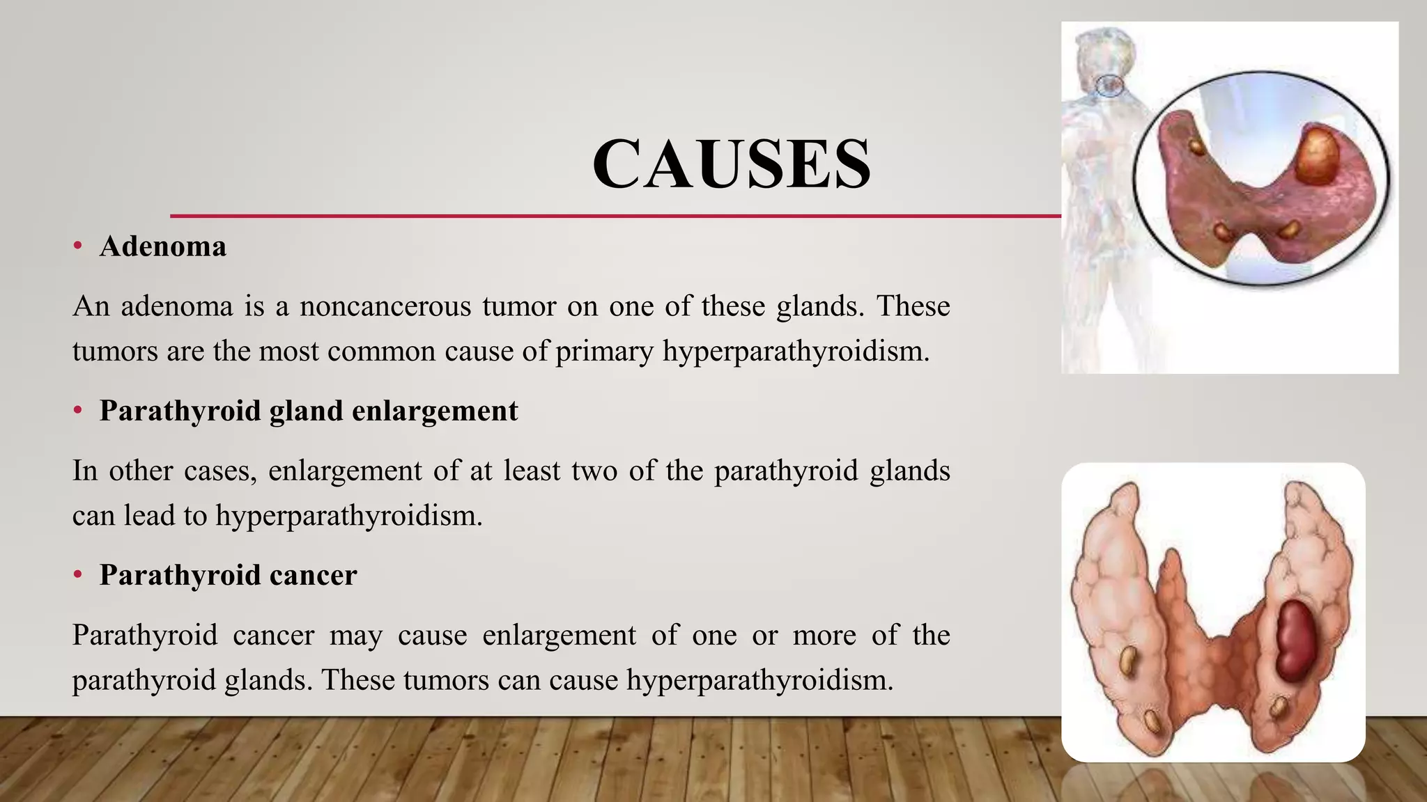Primary hyperparathyroidism | PPTX