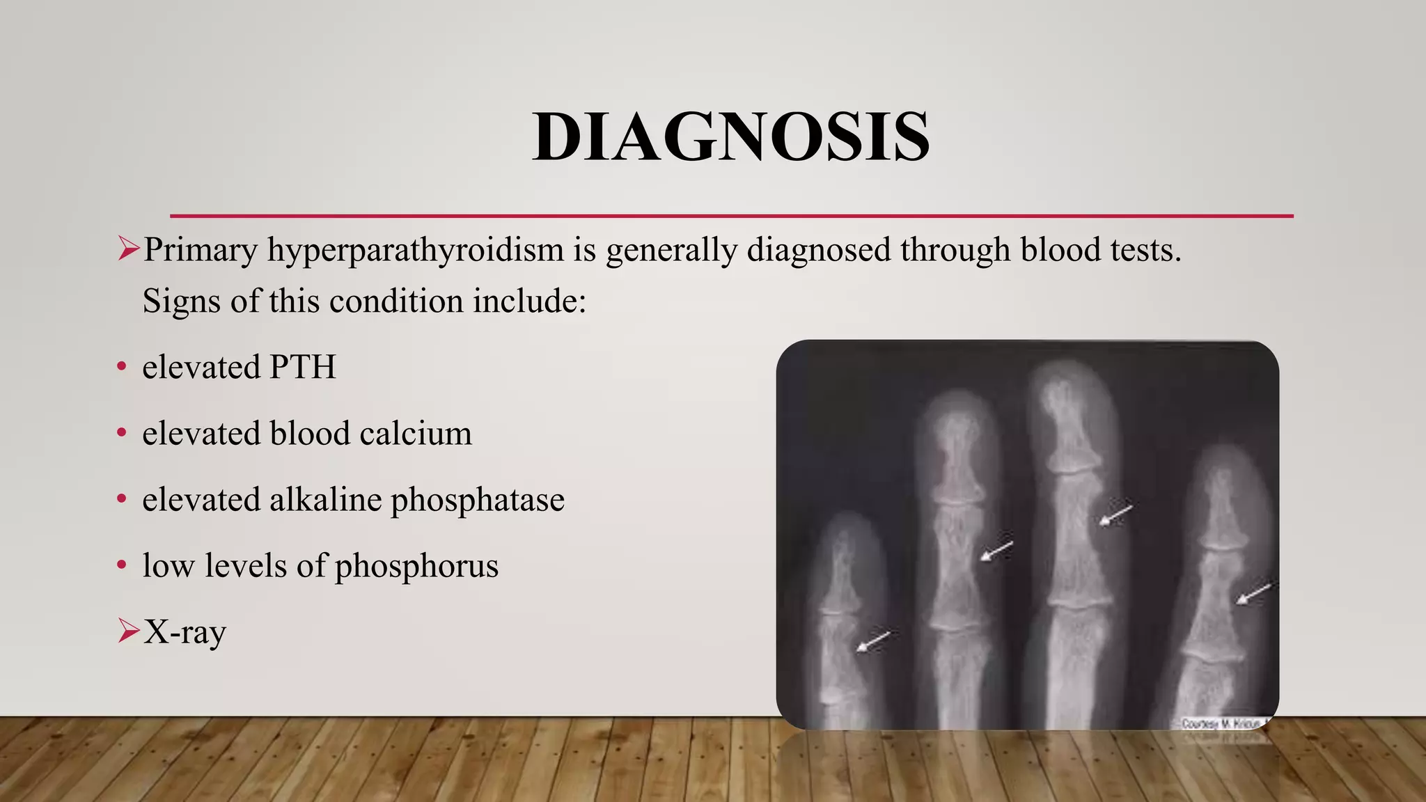 Primary hyperparathyroidism | PPTX