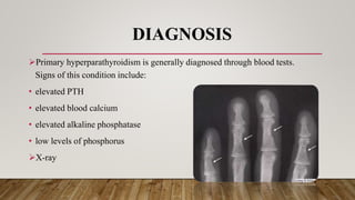 Primary hyperparathyroidism | PPTX