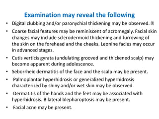Primary hypertrophic osteoarthropathy (hpoa) | PPTX
