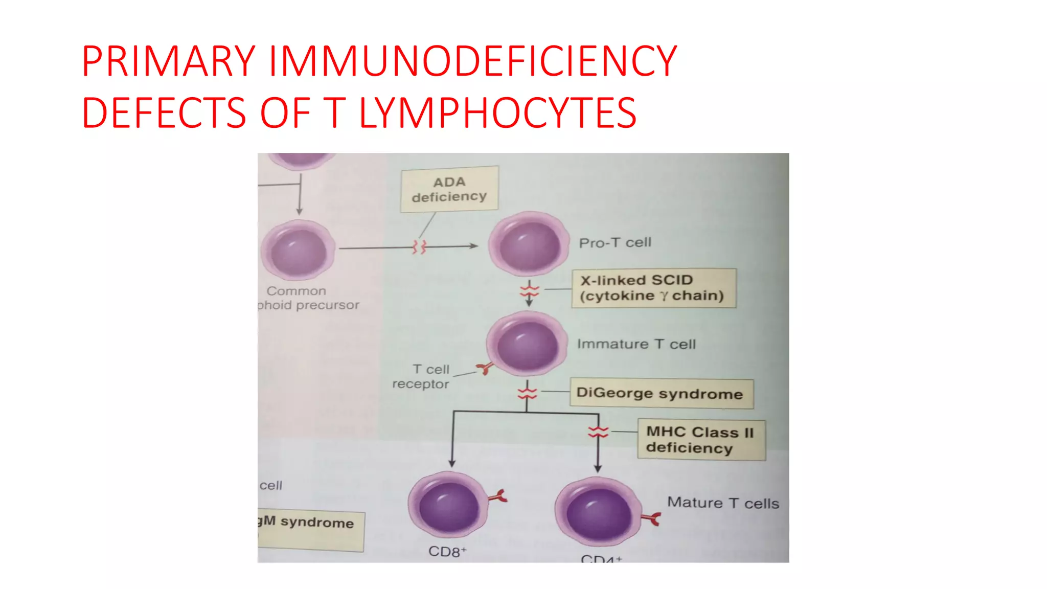 PRIMARY IMMUNE DEFICIENCY DISEASES | PPT