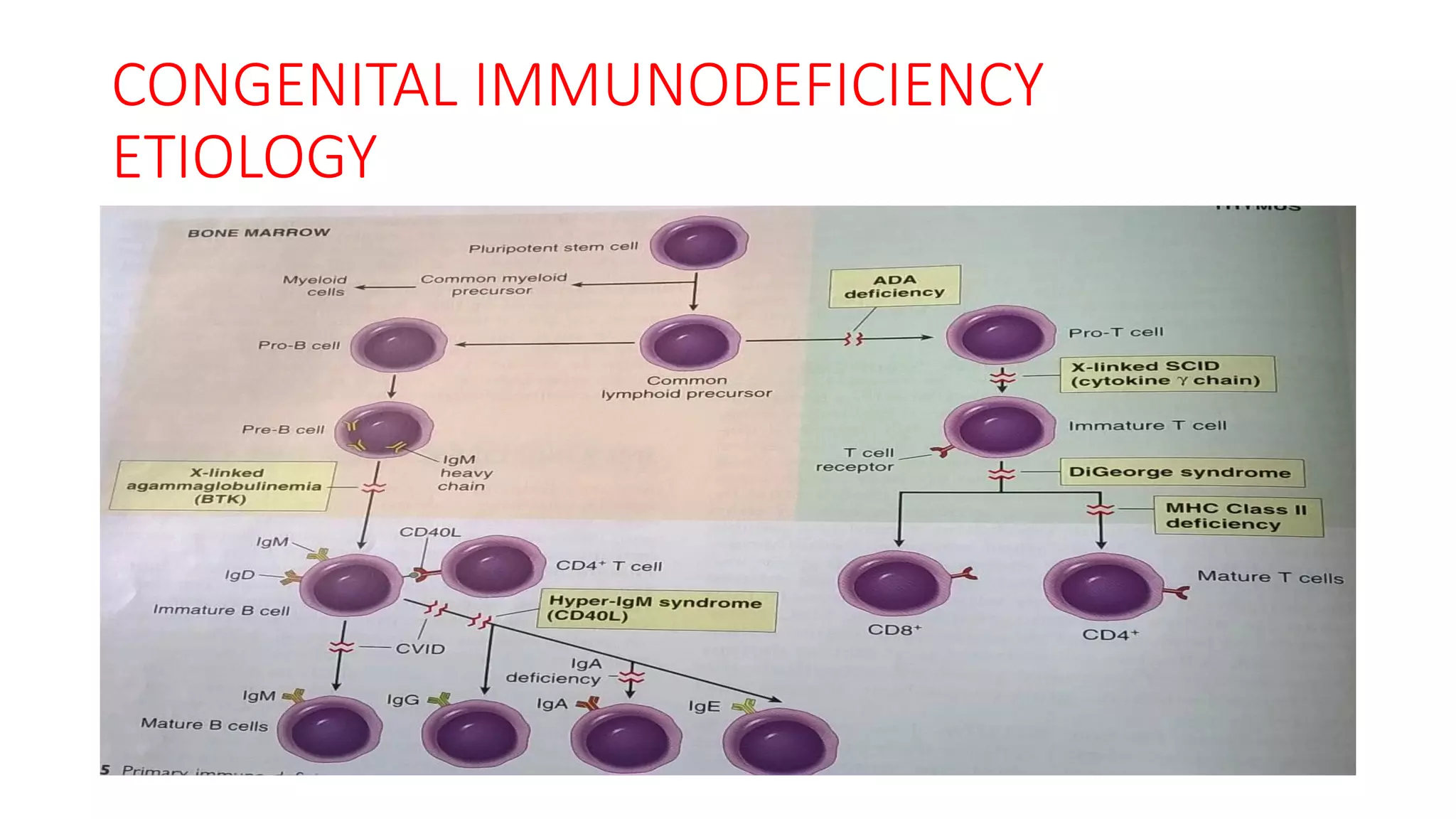 PRIMARY IMMUNE DEFICIENCY DISEASES | PPT