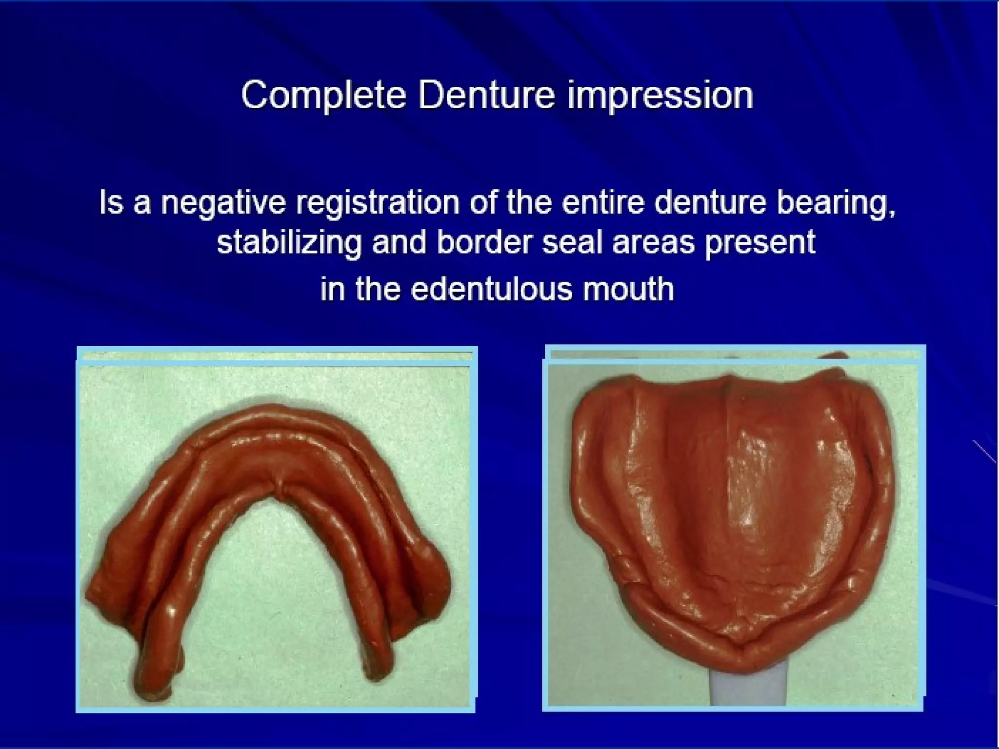 Primary impression | PPT