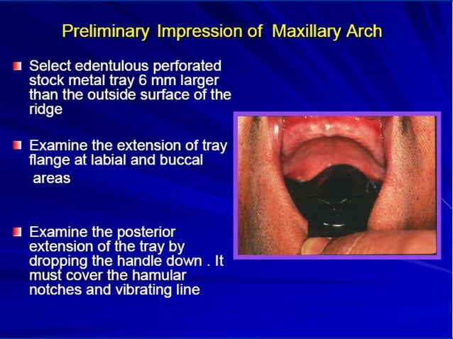 Primary impression | PPT