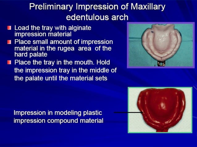 Primary impression | PPT