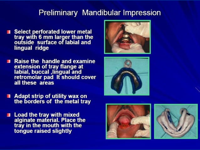 Primary impression | PPT
