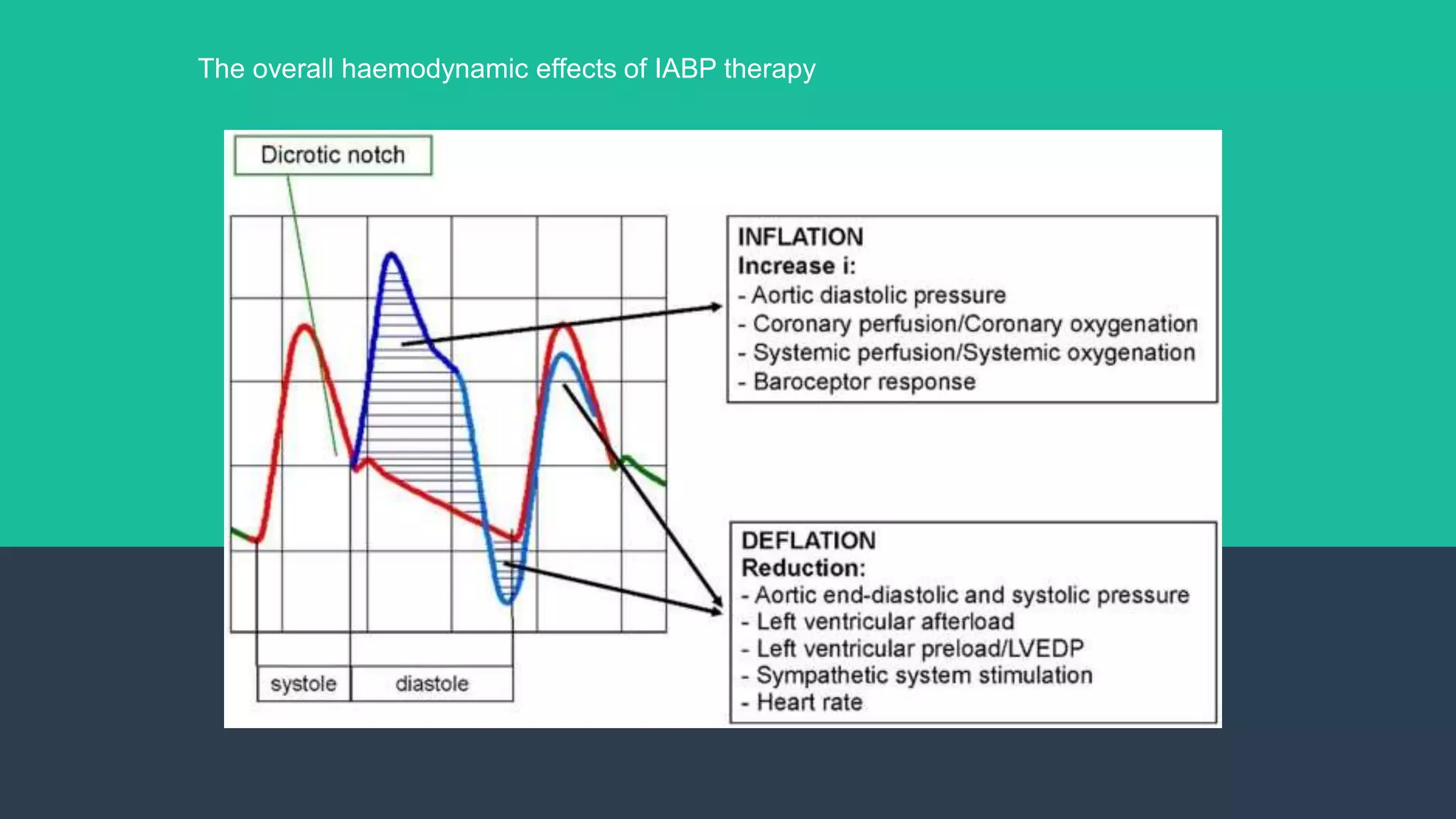 Primary intra aortic balloon pump (p iabp) | PPT