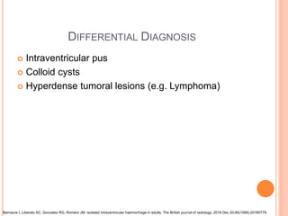 Primary Intraventricular Haemorrhage | PPTX