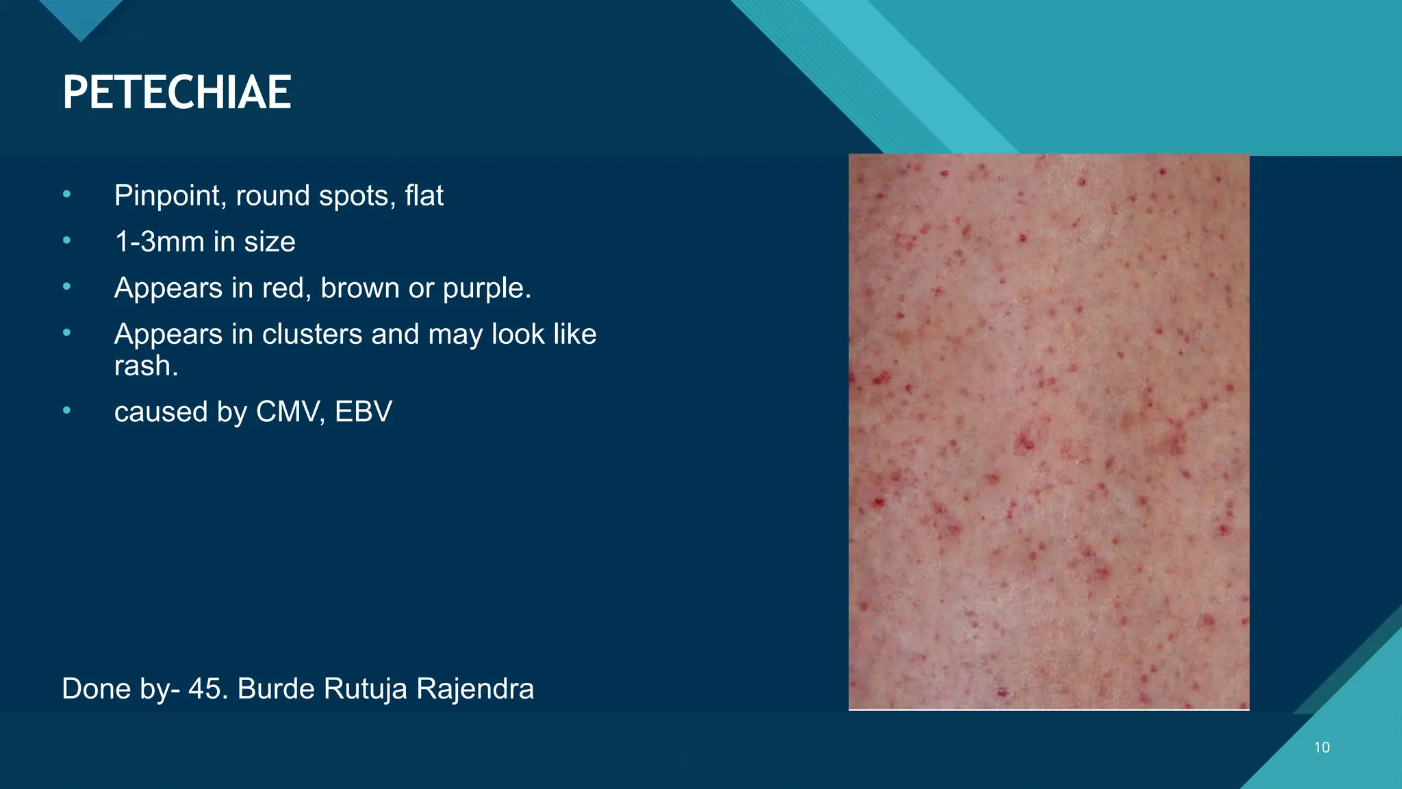 DERMATOLOGY SKIN PIGMENTPRIMARY LESIONS.pptx