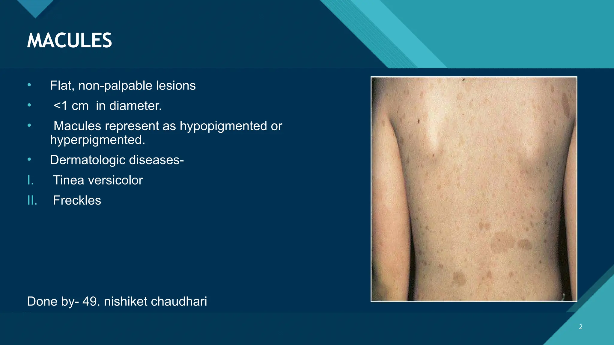 DERMATOLOGY SKIN PIGMENTPRIMARY LESIONS.pptx
