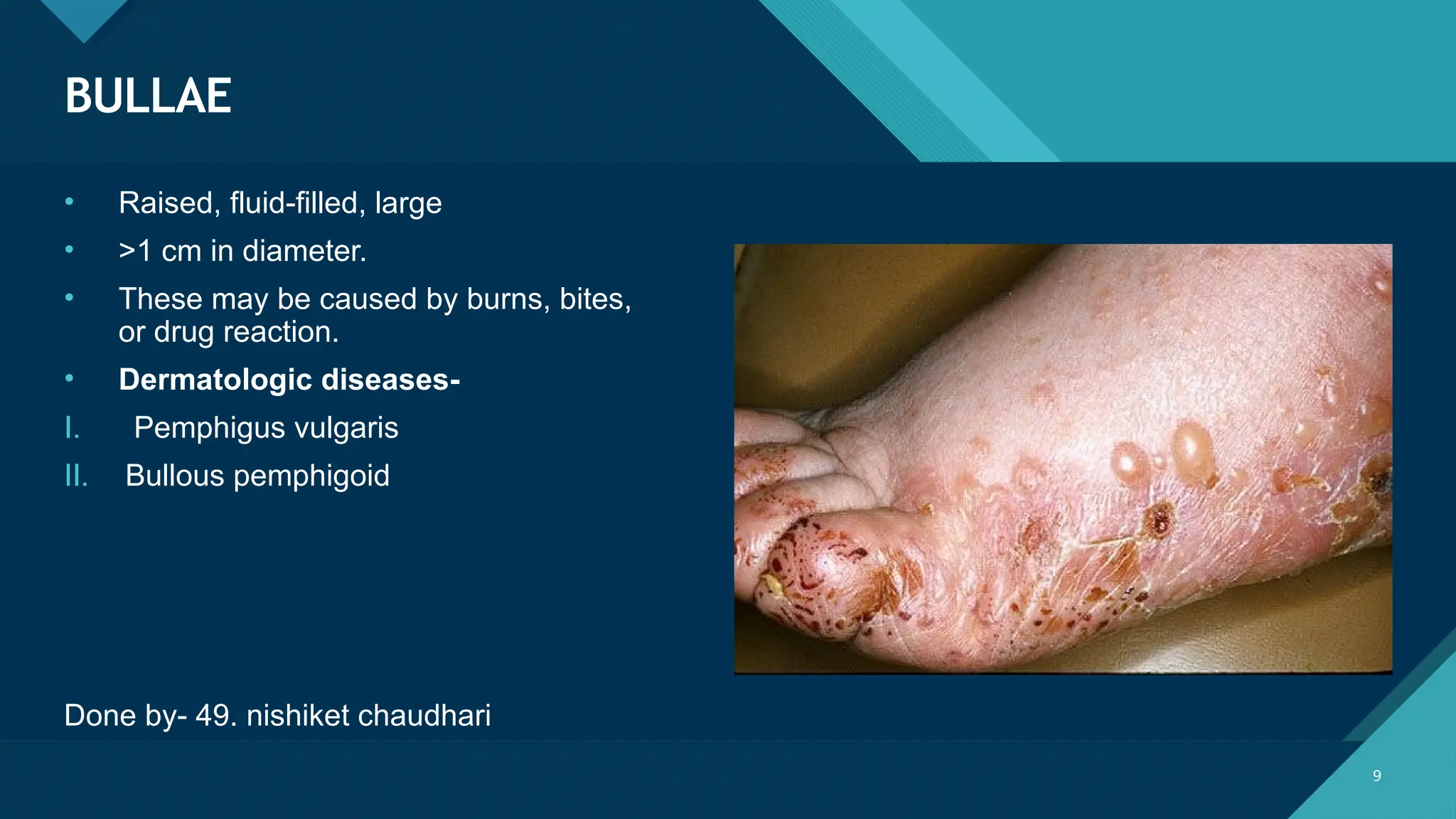 DERMATOLOGY SKIN PIGMENTPRIMARY LESIONS.pptx