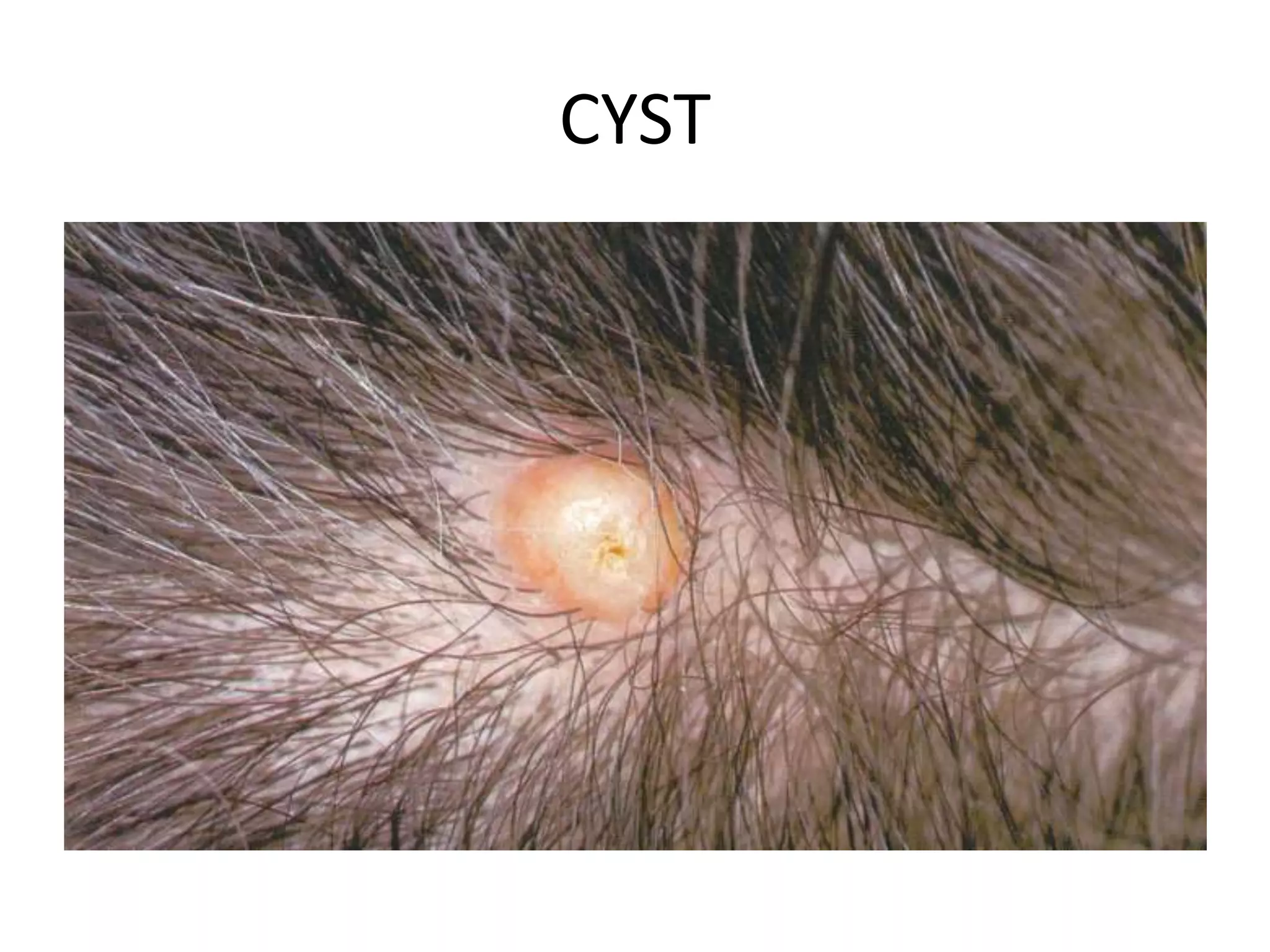 Primary Skin Lesions by Aseem | PPTX