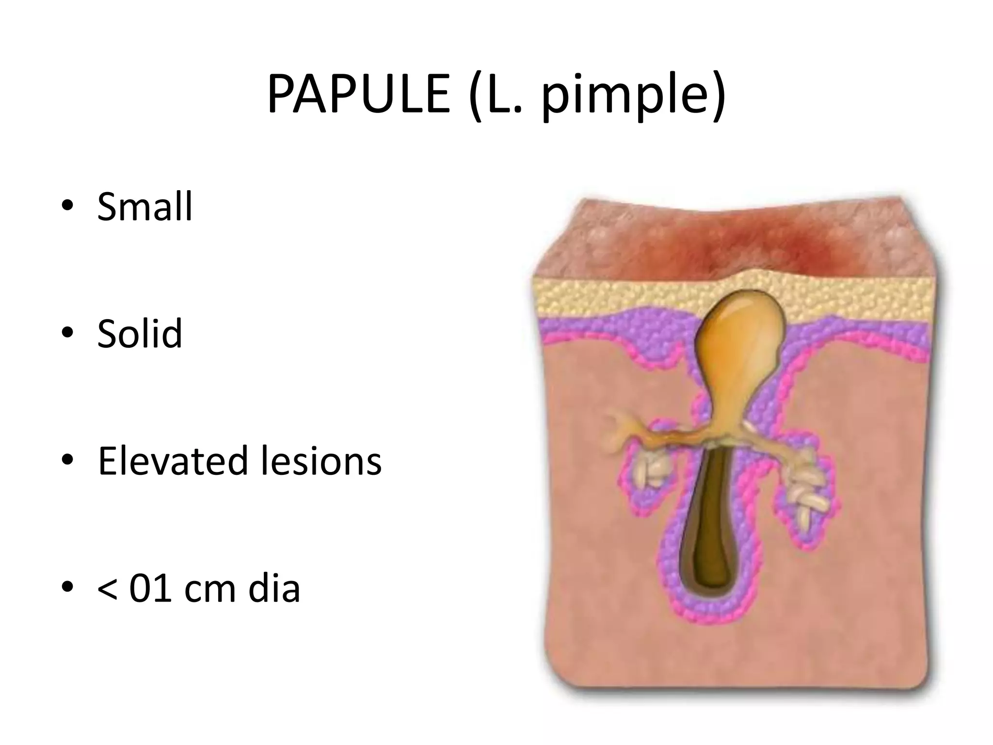 Primary Skin Lesions by Aseem | PPTX