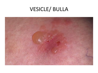 Primary Skin Lesions by Aseem | PPTX