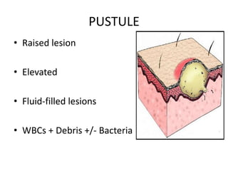 Primary Skin Lesions by Aseem | PPTX
