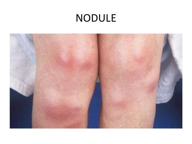 Primary Skin Lesions by Aseem