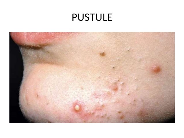 Primary Skin Lesions by Aseem