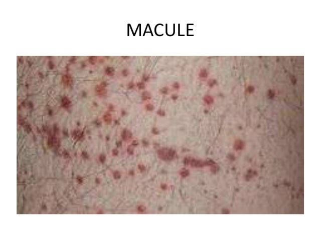 Primary Skin Lesions by Aseem