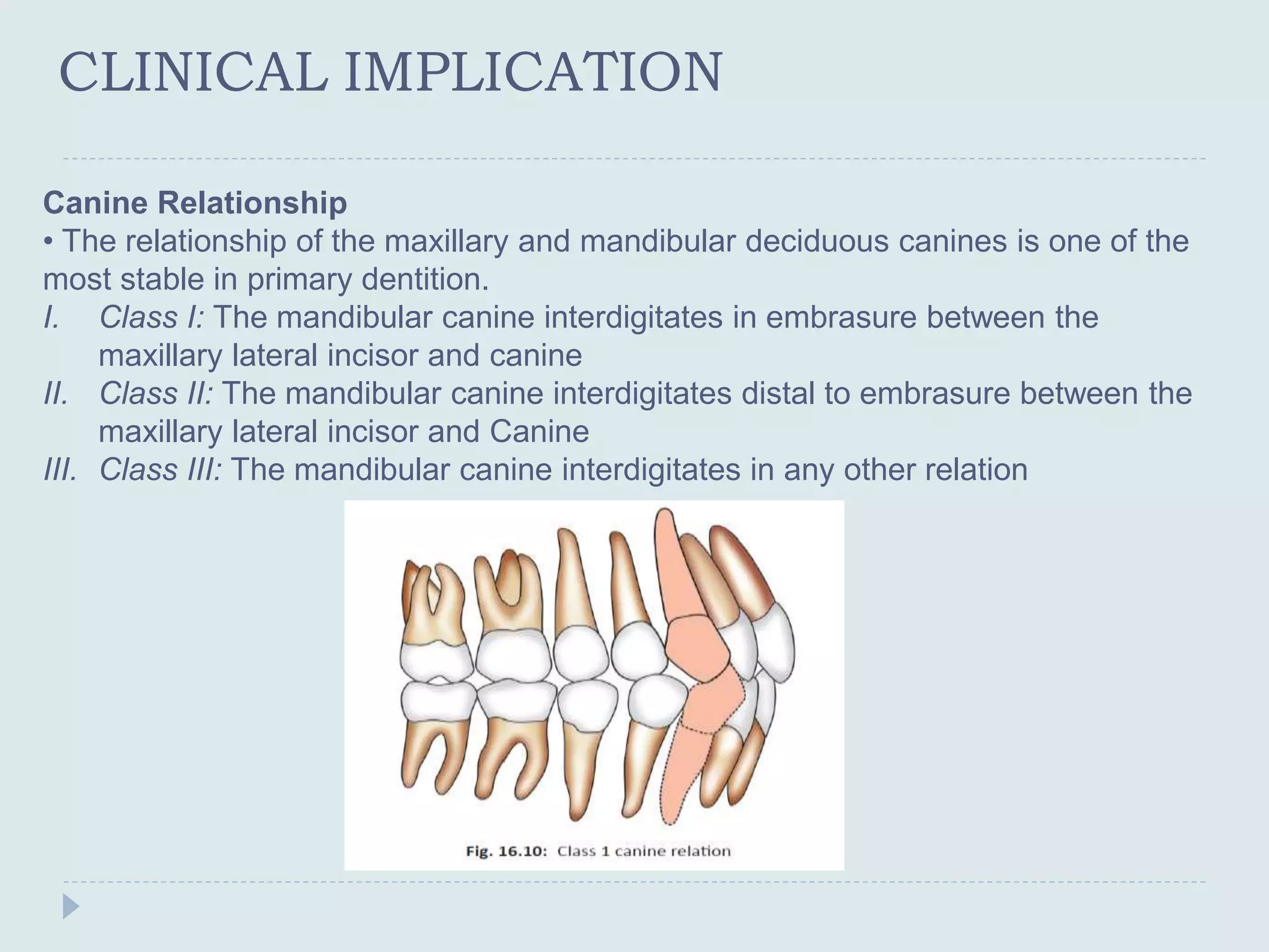 Primary mandibular canine | PPTX