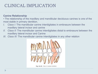 Primary mandibular canine | PPTX