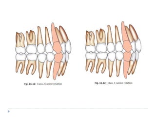 Primary mandibular canine | PPTX