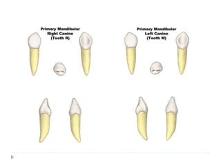 Primary mandibular canine | PPTX