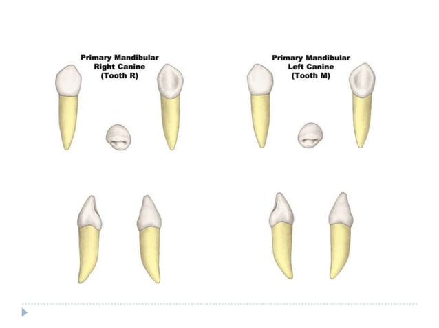 Primary mandibular canine | PPTX | Dental Health | Diseases and Conditions