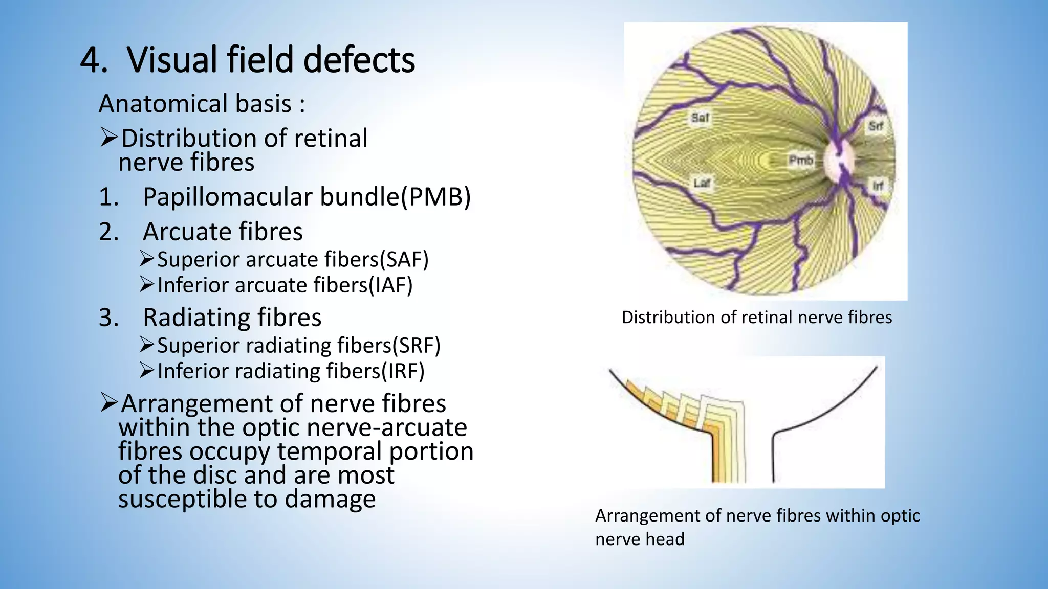 Primary open angle glaucoma | PPTX