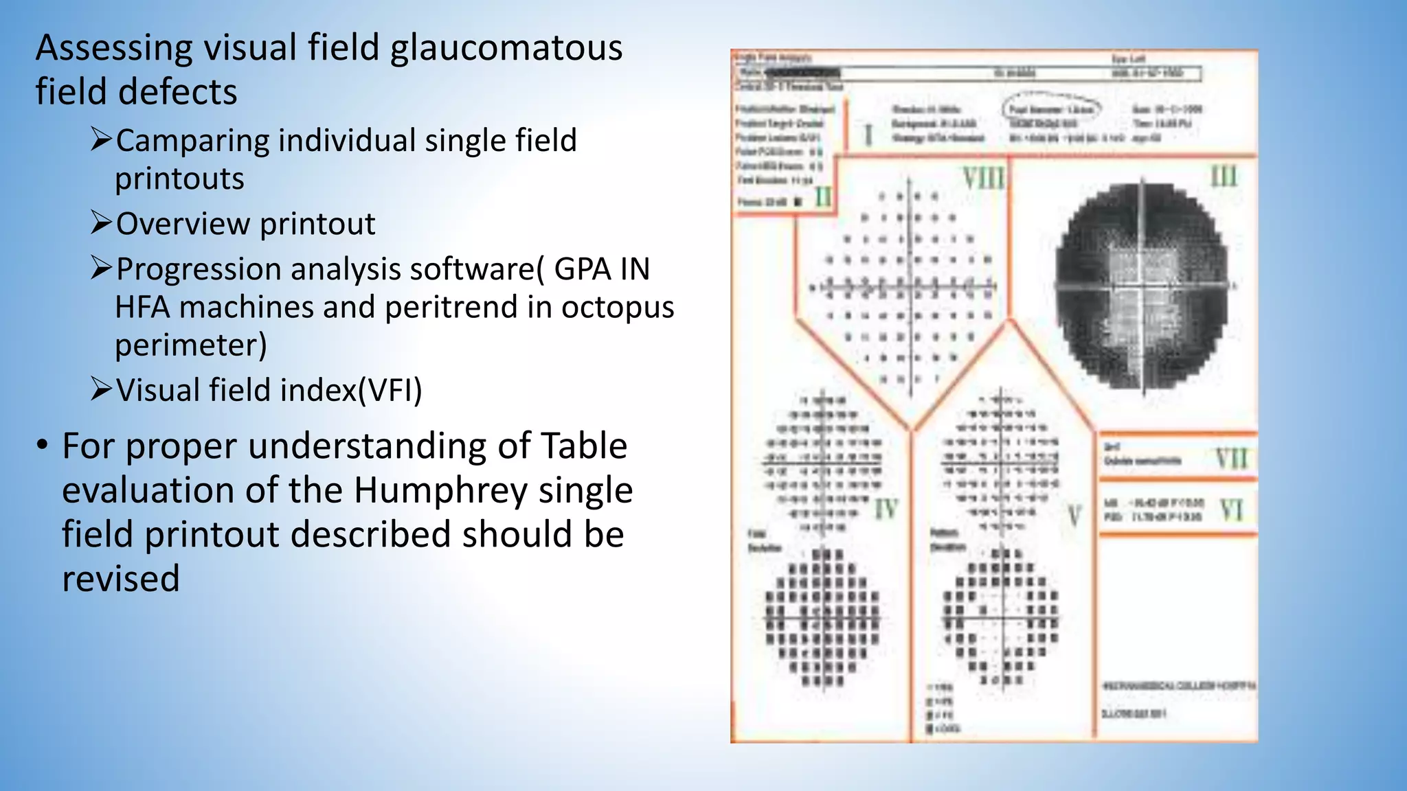 Primary open angle glaucoma | PPTX