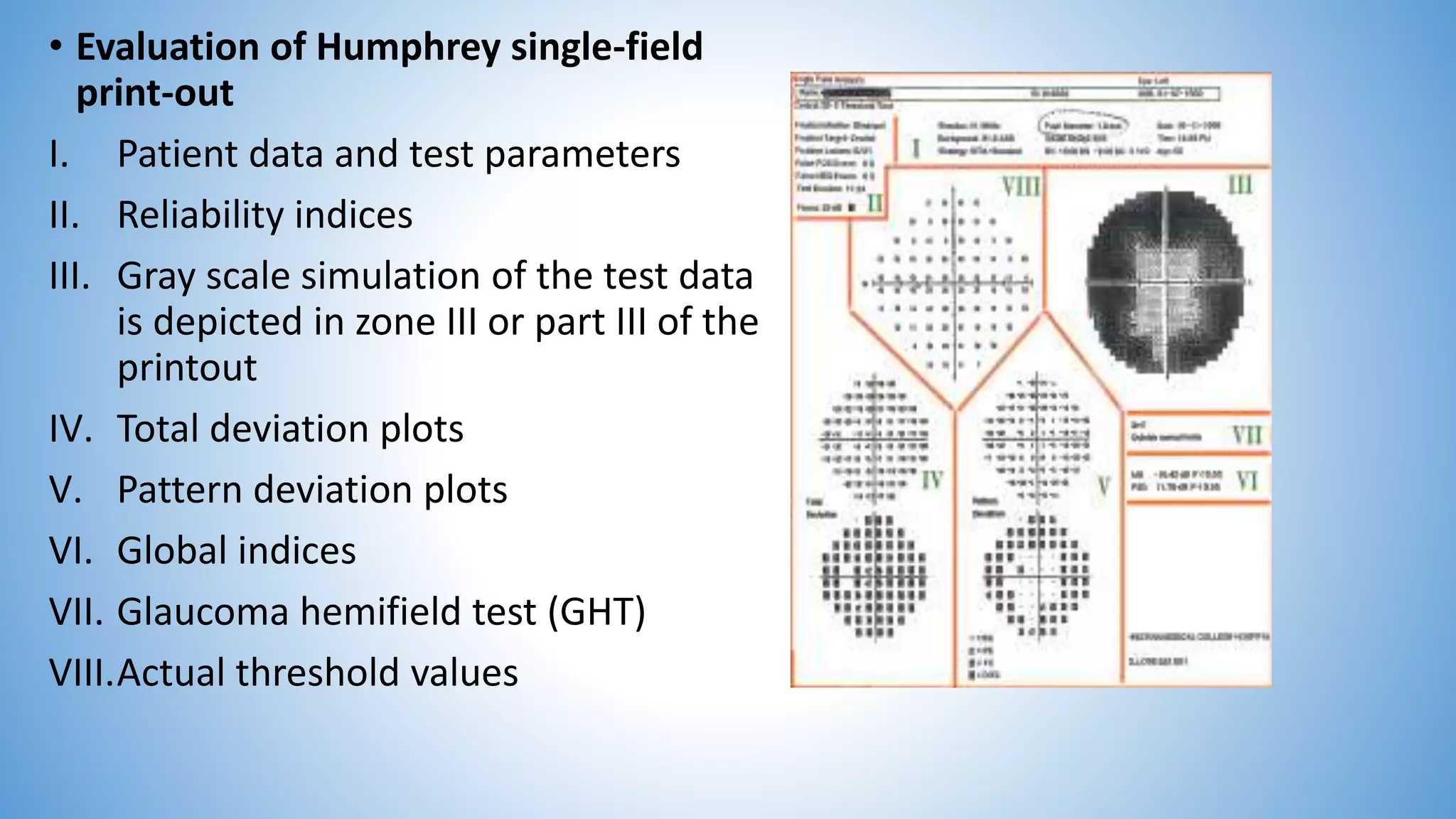 Primary open angle glaucoma | PPTX