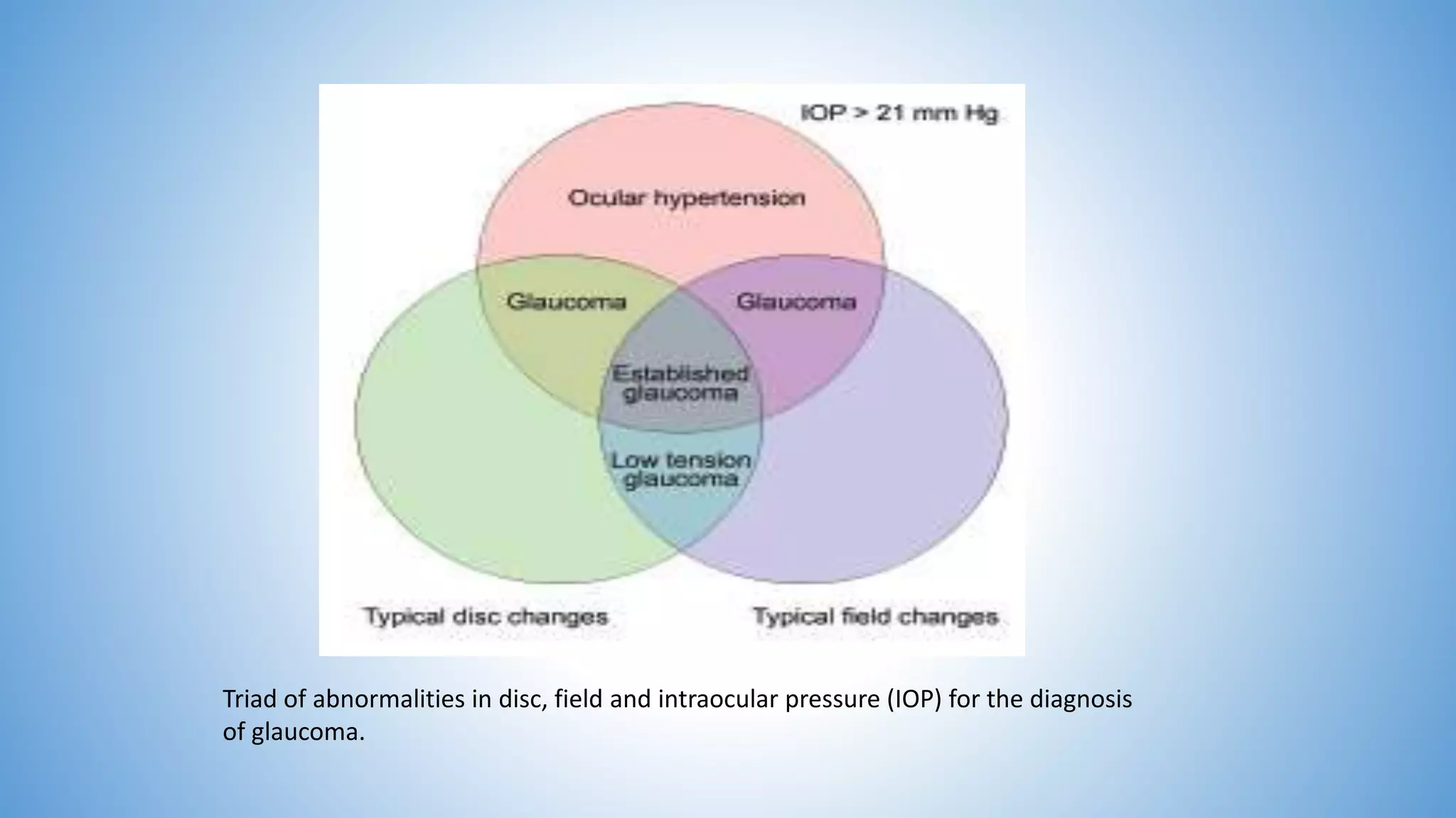Primary open angle glaucoma | PPTX