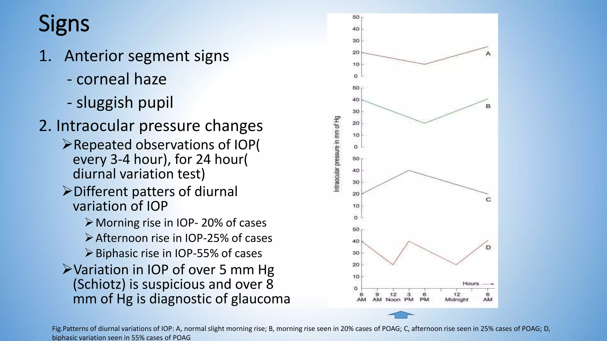 Primary open angle glaucoma | PPTX