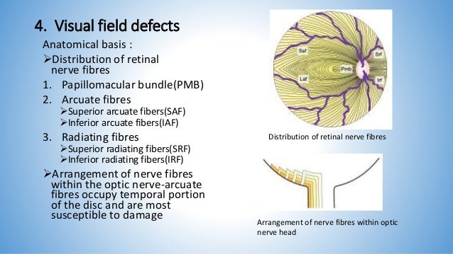 Primary open angle glaucoma