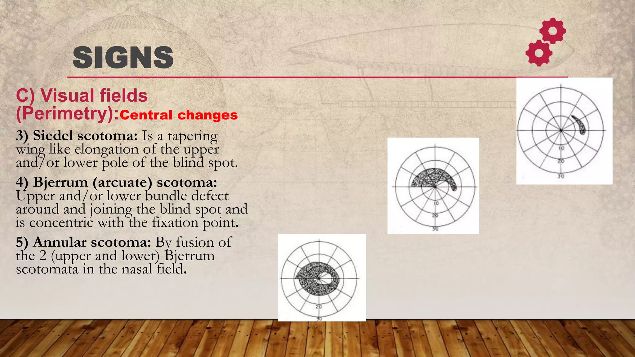 Primary open angle glaucoma | PPTX