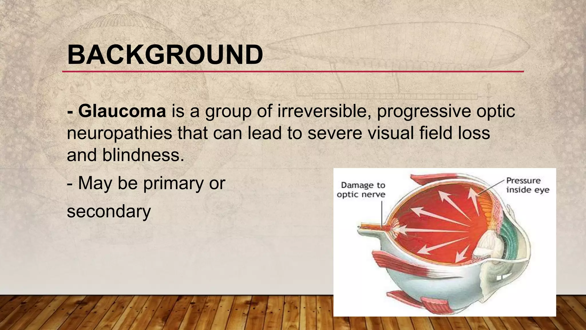 Primary open angle glaucoma | PPTX