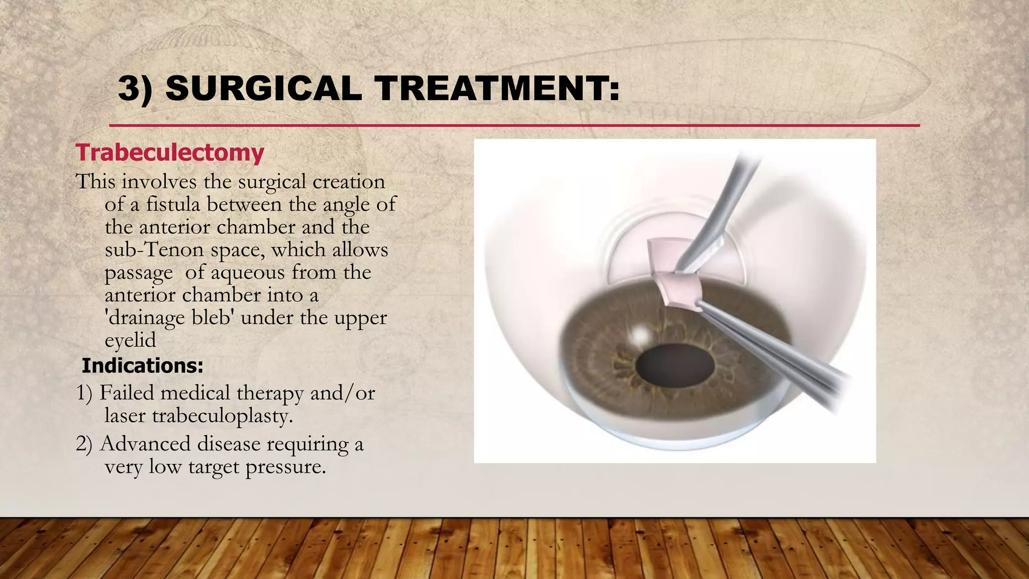 Primary open angle glaucoma | PPTX