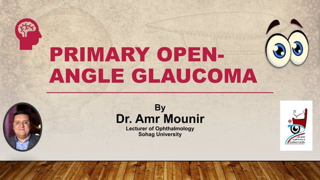 Primary open angle glaucoma | PPTX | Eye and Vision Conditions | Diseases and Conditions