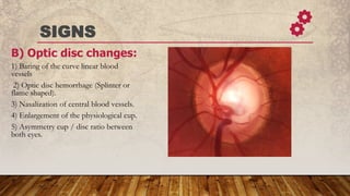 Primary open angle glaucoma | PPTX