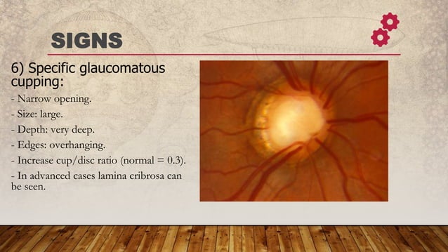 Primary open angle glaucoma | PPTX | Eye and Vision Conditions | Diseases and Conditions
