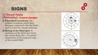 Primary open angle glaucoma | PPTX