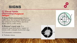 Primary open angle glaucoma | PPTX