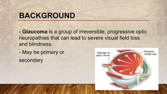 Primary open angle glaucoma | PPT