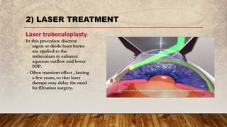 Primary open angle glaucoma | PPTX