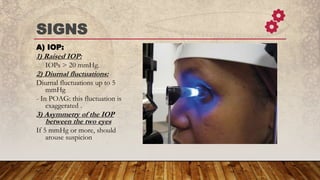 Primary open angle glaucoma | PPTX