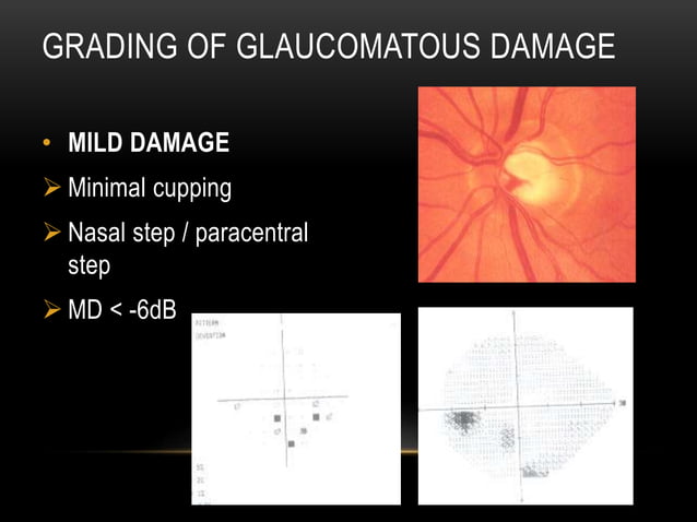 Primary open angle glaucoma (poag) | PPTX | Eye and Vision Conditions | Diseases and Conditions