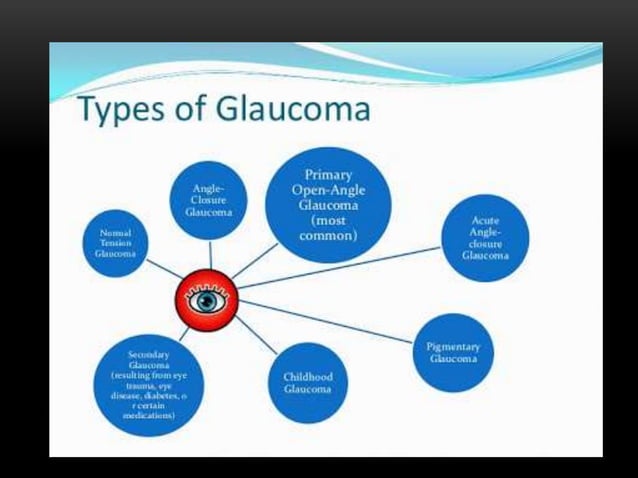 Primary open angle glaucoma (poag) | PPTX | Eye and Vision Conditions ...