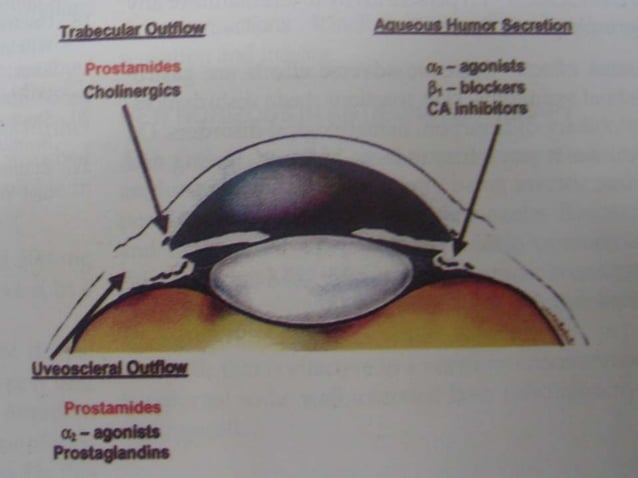 Primary open angle glaucoma (poag) | PPTX | Eye and Vision Conditions ...
