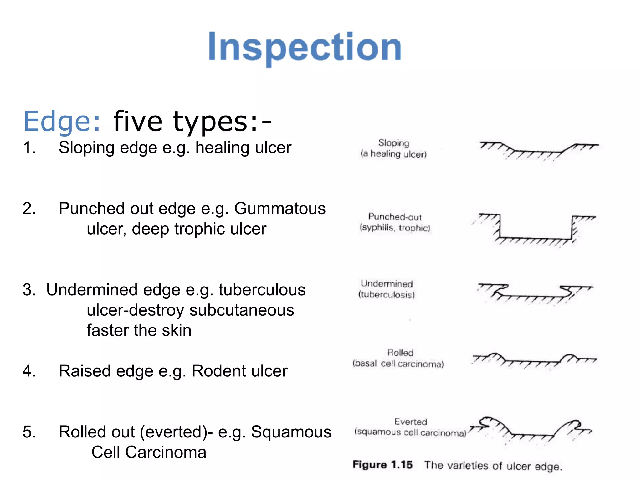 Primary Oral Ulceration.pptx
