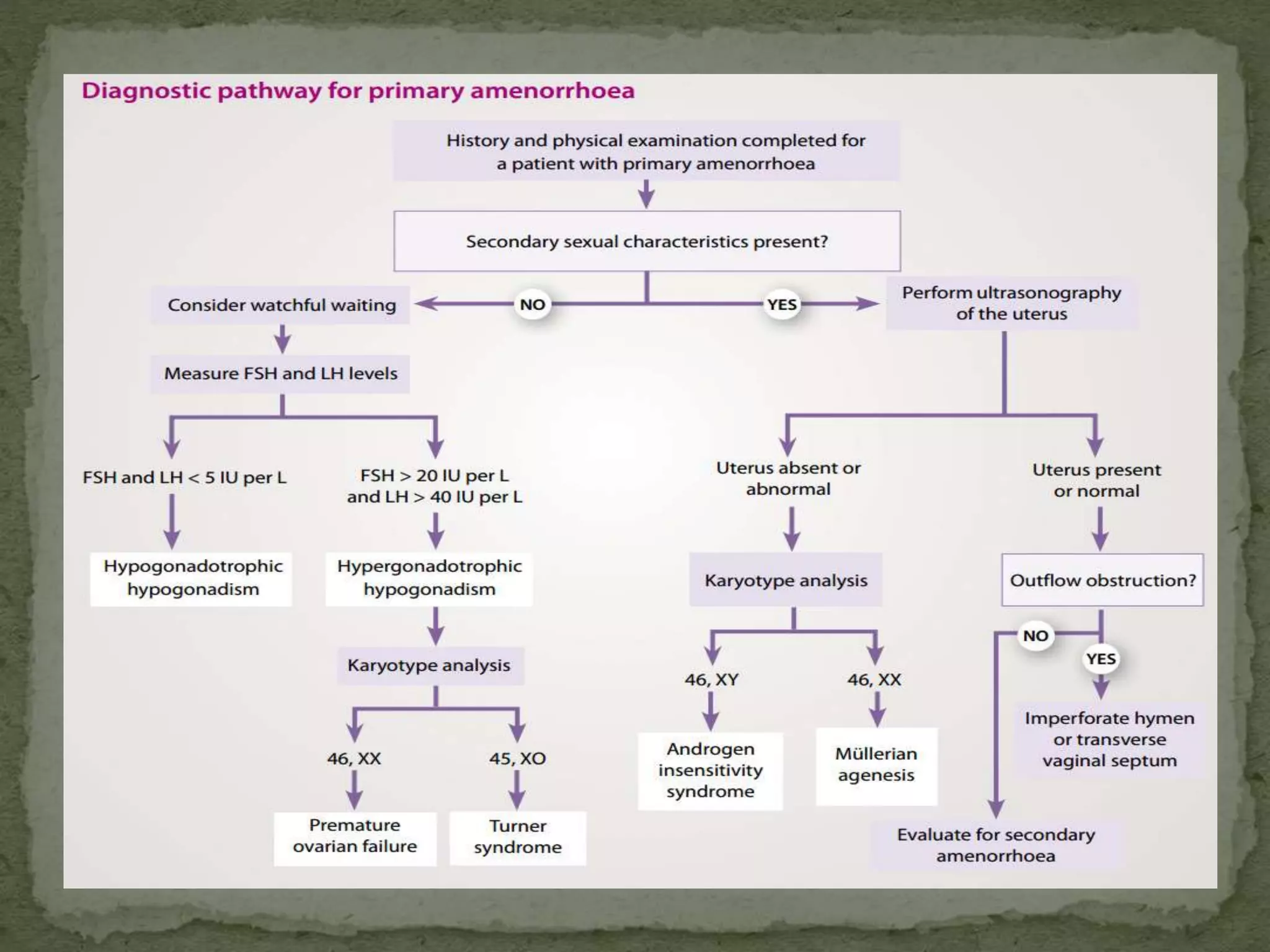 Primary ovarian insufficiency | PPTX